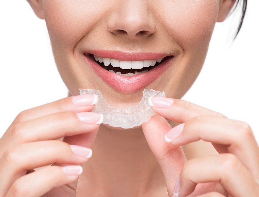 Occlusal Splints - Appin Dental Surgery - Appin NSW