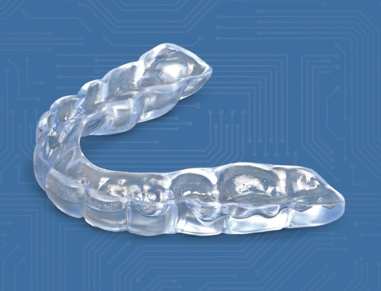 Occlusal Splints - Appin Dental Surgery - Appin NSW